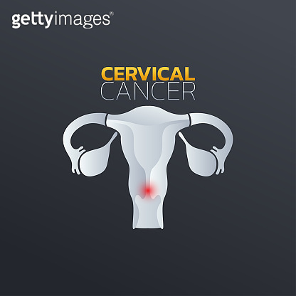 cervical cancer icon design, infographic health. Vector illustration ...