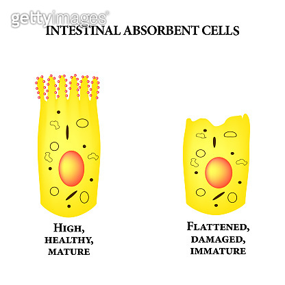 Structure of the enterocyte. Deformed, sick cell. absorptive cells ...
