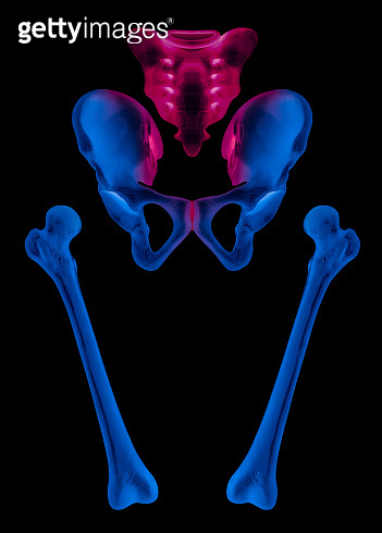 X-ray of separate human hip and femur bone anterior view red highlight ...