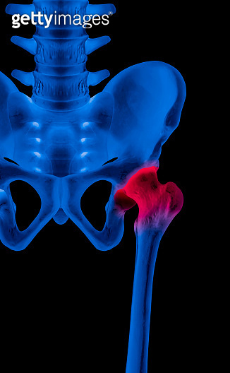 X-ray of lower half length human skeleton anterior view red highlight ...