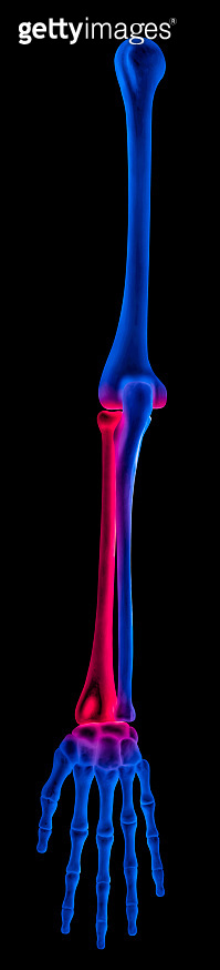 X-ray of human forearms bone anterior view -Red highlight in radius ...