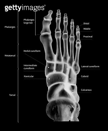 Infographic diagram of human foot bone anatomy system anterior view- 3D ...
