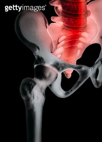 X-ray of lower half length human skeleton lateral view red highlight on ...