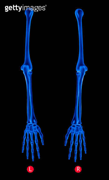 X-ray of the human forearm bone anterior view- Left and Right hand-3D ...