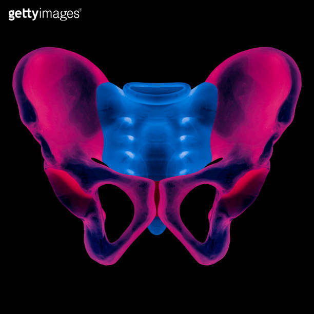 X-ray of human pelvis bone anterior view red highlight in hip bone pain ...