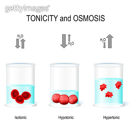 Isotonic, Hypotonic and Hypertonic solutions effects on animal cells ...