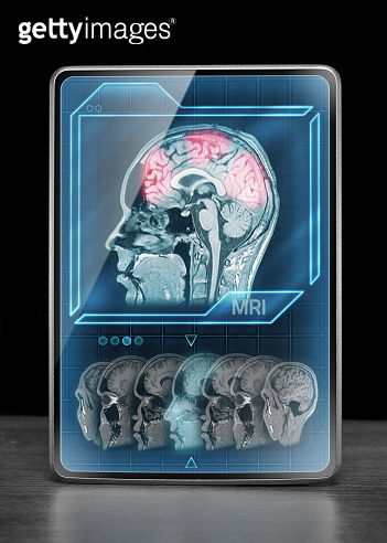 Brain activity scan (1068581822) - 게티이미지뱅크