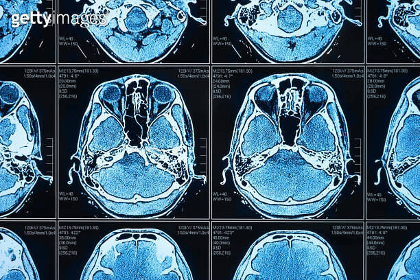 Artificial intelligence in smart healthcare hospital technology concept ...