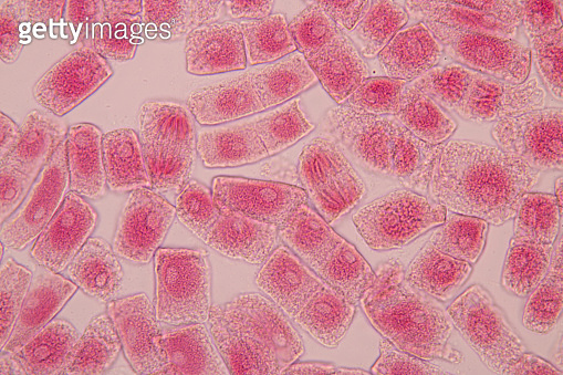 Mitosis cell in the Root tip of Onion under a microscope. (1080806518 ...