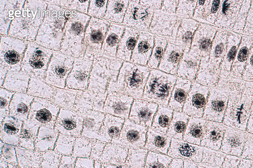 Mitosis cell in the Root tip of Onion under a microscope. 이미지 ...