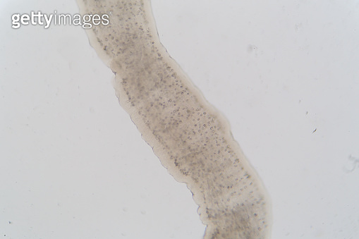 Tapeworm infection is the infestation of the digestive tract by a ...