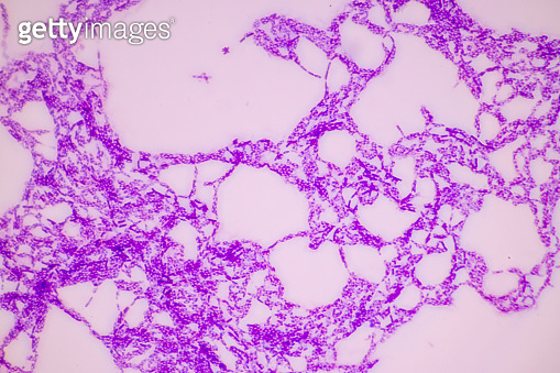 Bacteria on slide under the microscope constitute a large domain of ...