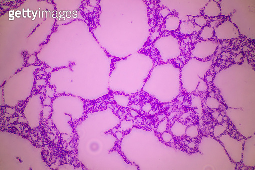 Bacteria on slide under the microscope constitute a large domain of ...