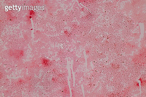 Bacteria on slide under the microscope constitute a large domain of ...