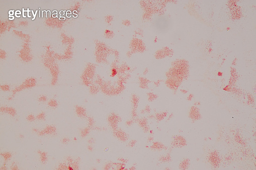 Bacteria on slide under the microscope constitute a large domain of ...