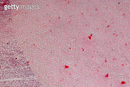Bacteria on slide under the microscope constitute a large domain of ...