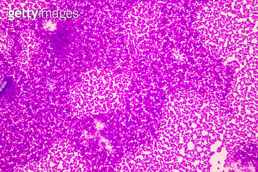 Bacteria on slide under the microscope constitute a large domain of ...