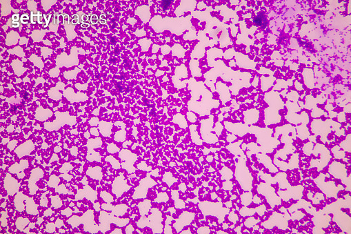 Bacteria on slide under the microscope constitute a large domain of ...