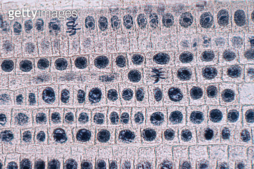 Root tip of Onion and Mitosis cell in the Root tip of Onion under a ...
