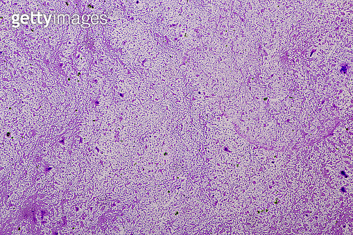 Bacteria on slide under the microscope constitute a large domain of ...