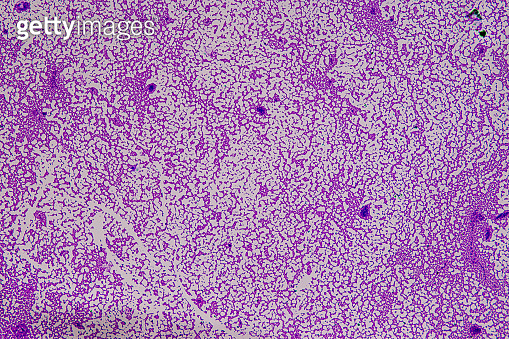 Bacteria on slide under the microscope constitute a large domain of ...