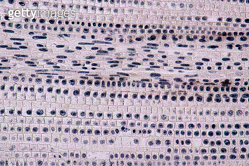 Root tip of Onion and Mitosis cell in the Root tip of Onion under a ...