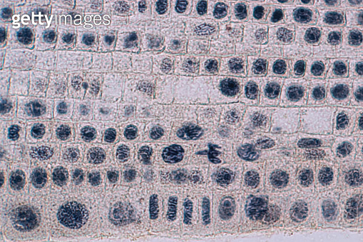 Root tip of Onion and Mitosis cell in the Root tip of Onion under a ...