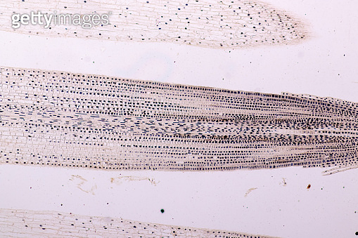 Root tip of Onion and Mitosis cell in the Root tip of Onion under a ...