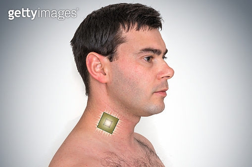 Bionic chip (processor) implant in male human body (912413902) - 게티이미지뱅크