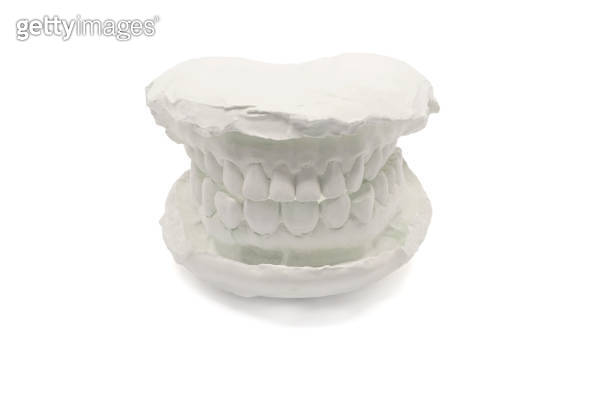 Dental model plaster on white background,isolated.Plaster model jaw ...