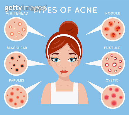 Face acne women skin cosmetic care pimple problem beauty cosmetics ...