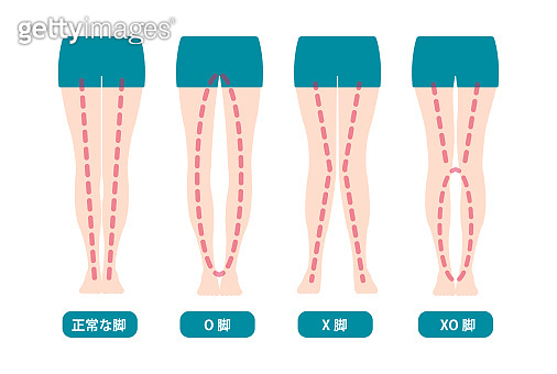 Difference types of legs angles and knees vector illustration (Japanese ...