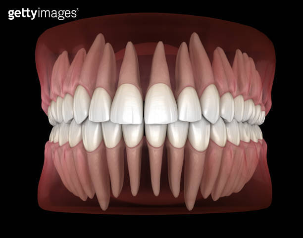 Morphology of mandibular and maxillary human gum and teeth. Medically ...