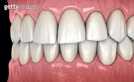 Healthy human teeth with normal occlusion, side view. Medically ...