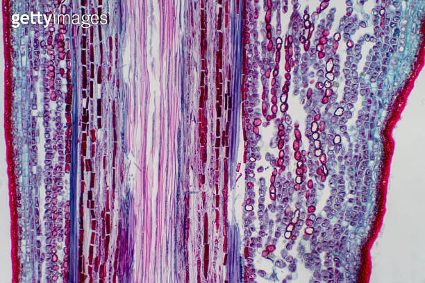 Plant vascular tissue under the microscope view for education ...