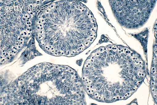 Cross section Human testis under microscope view. Shows spermatogonia ...