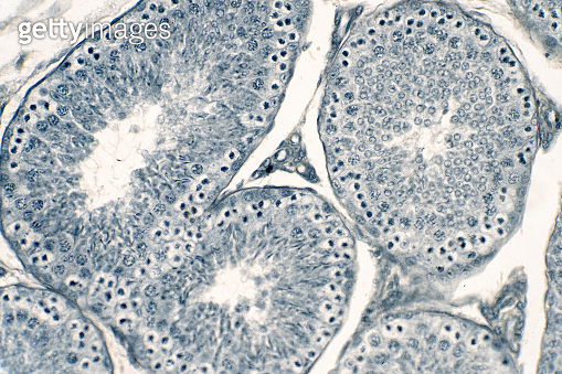 Cross section Human testis under microscope view. Shows spermatogonia ...