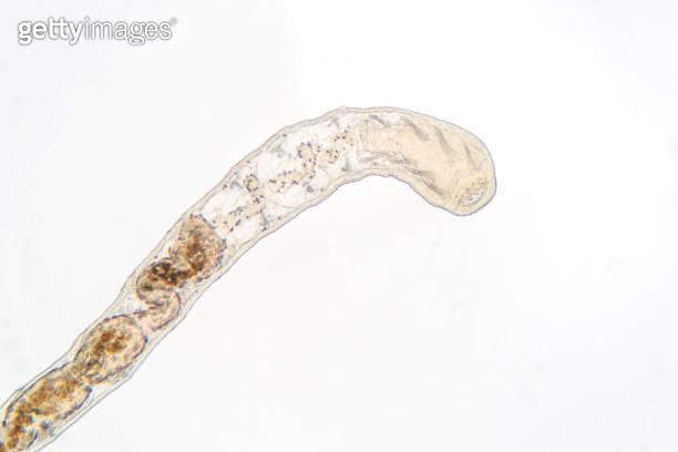 Tubifex worm under the microscope view for education. 이미지 (1165424190 ...