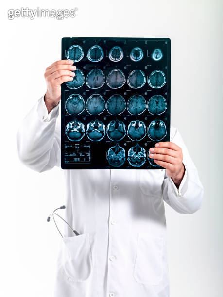 Medical doctor analyzing a CT scan 이미지 (1167395231) - 게티이미지뱅크