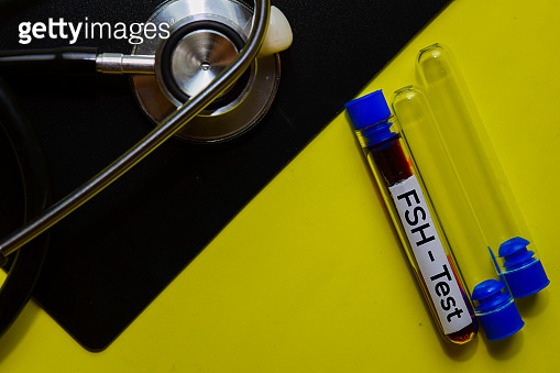FSH - Test with blood sample. Top view isolated on color background ...