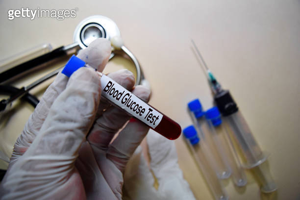 Blood Glucose Test text on Sticky Notes. Top view isolated on office ...