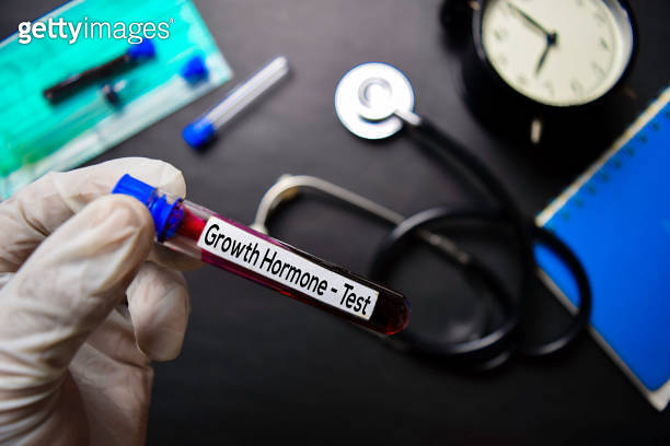 Growth Hormone - Test with blood sample. Top view isolated on black ...