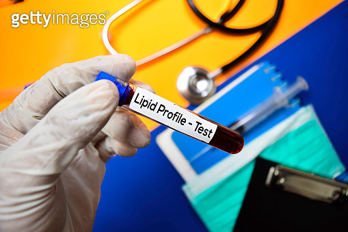 Lipid Profile - Test with blood sample. Top view isolated on color ...