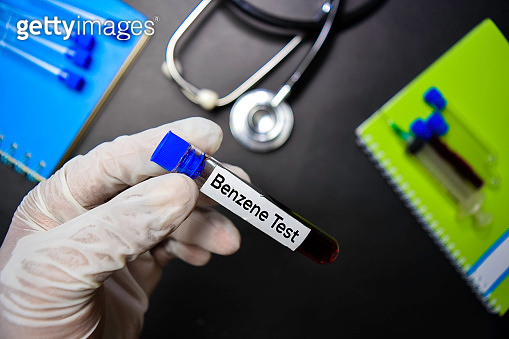 Benzene Test text with blood sample. Top view isolated on black ...