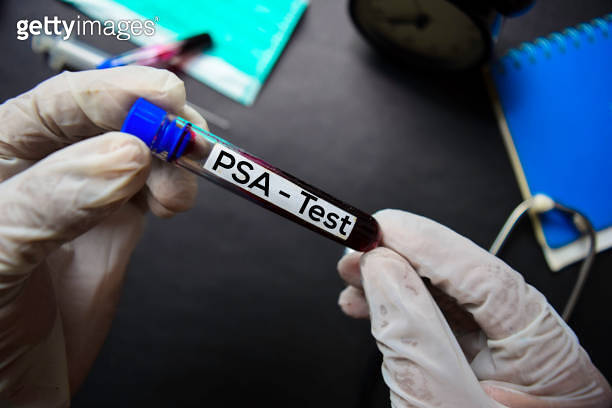 PSA - Test with blood sample. Top view isolated on black background ...