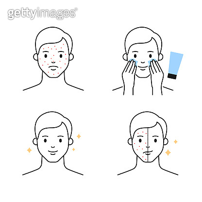 Acne problems and treatments male character outline vector icons 이미지 ...