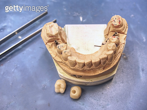 Sharpened and polished tooth model on dental construction 이미지 ...