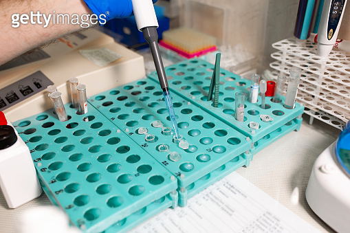 laboratory assistant analyzing a blood sample using micropipette. 이미지 ...