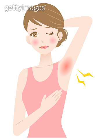 woman’s armpit hair removal. underarm red rash. beauty and healthy skin ...