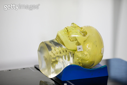 Human tissue mimicking mannequin head on a medical linear accelerator ...